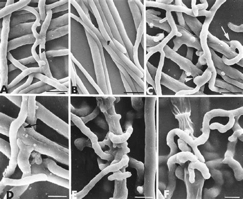 Scanning Electron Micrographs Of Pythium Oligandrum Hyphae Interacting