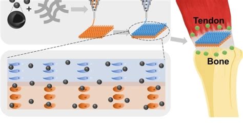 生物陶瓷 3d打印，上海硅酸盐所为肌腱 骨再生提供新策略 腾讯新闻
