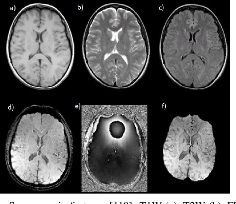 Review Of Methods For Automatic Cerebral Microbleeds Detection Paper And Code