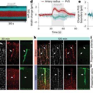 Perivascular CSF Flow Kinetics Is Closely Controlled By Arterial Download Scientific Diagram