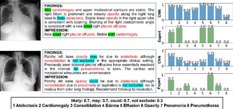 Figure From Expert Uncertainty And Severity Aware Chest X Ray