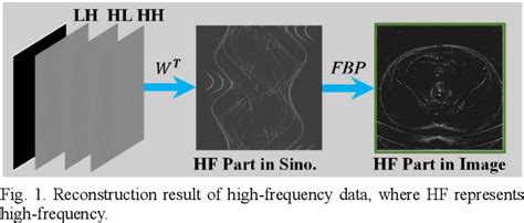 Figure 1 From Stage By Stage Wavelet Optimization Refinement Diffusion Model For Sparse View Ct