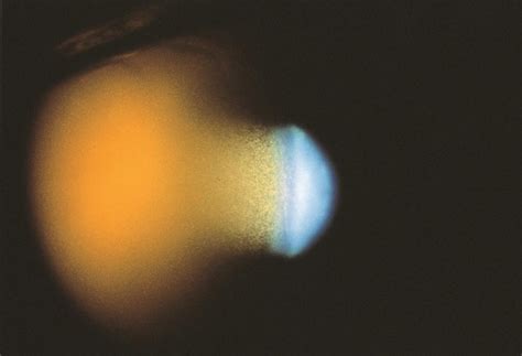 Filefigure 10 Ghost Cell Eyewiki