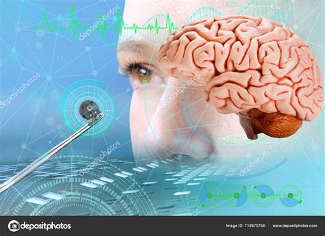 Electronic Chip Bug Scientist S Hand Successful Implantation Wireless Chip Human Stock Photo