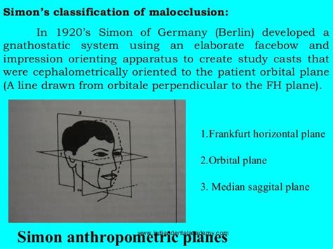 Classification Of Malocclusion 4