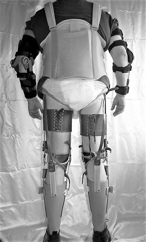 Pin By John Beeson On Leg Braces Leg Braces Legs Braces