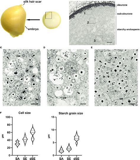 Mapping Of The Layers In The Endosperm A Thin Slices Of Endosperm Download Scientific