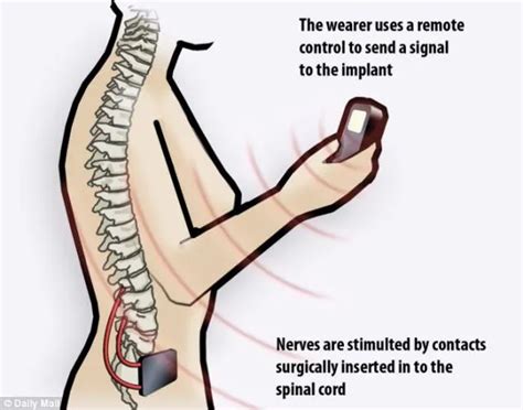 Implants And Remote Controlled Humans