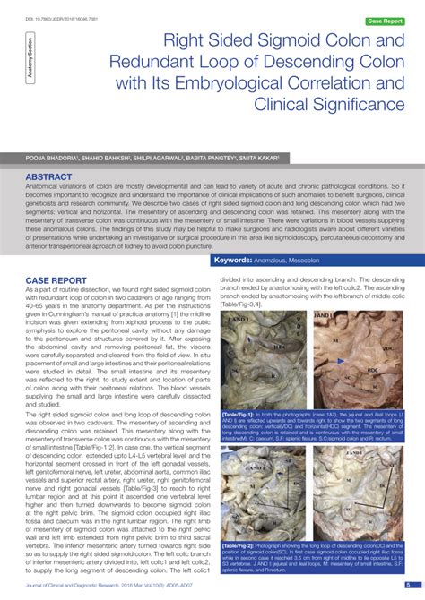 Pdf Right Sided Sigmoid Colon And Redundant Loop Of Descending Colon With Its Embryological