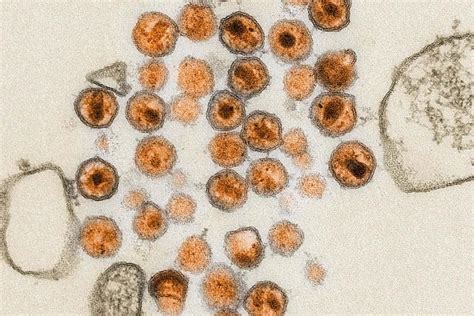 Crispr Could Disable And Cure Hiv Suggests Promising Lab Experiment Lifeboat News The Blog