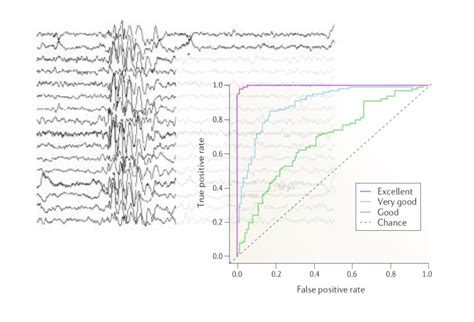 Seizure Prediction Performance Of Linear And Nonlinear Features Sapien Labs Shaping The