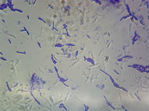 Prepared Microscope Slide Bacillus Subtilis Spore Forming Smear Gram Positive