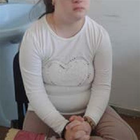 Smooth Diffuse Thyroid Swelling Figure 2 Onycholysis Plummers Nails Download Scientific