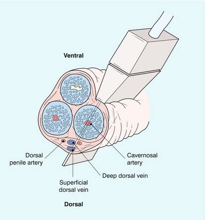 Doppler Ultrasound Of The Penis Clinical Gate