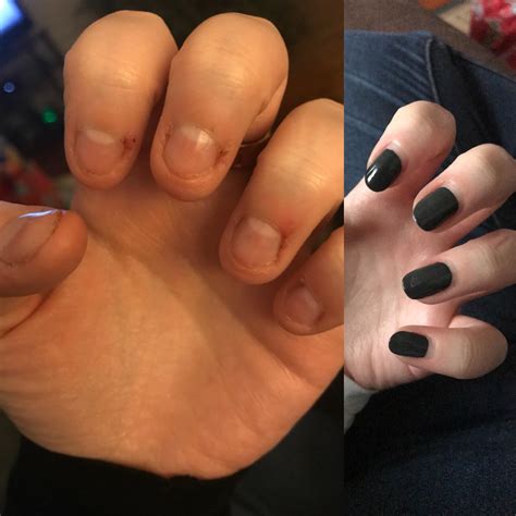 Ive Been Biting On And Off For Years This Is Two Months Of Progress I Was Complimented Twice