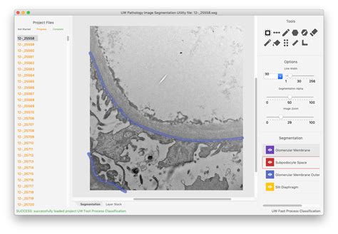 Uw Segmentation Utility Setup Mac Osx Lab Najafian