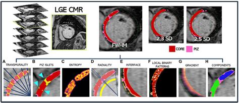 Extraction Methodology For A Single Patient Lge Cmr Dicom Slice To