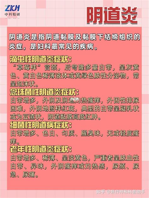 妇科炎症不重视？小心并发症！ 知乎