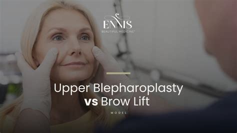 Upper Blepharoplasty Vs Brow Lift What Is The Difference Dr Ennis