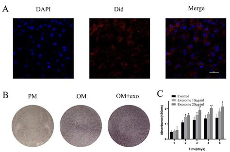 Effects Of Exosomes On Proliferation And Osteogenic Differentiation Of