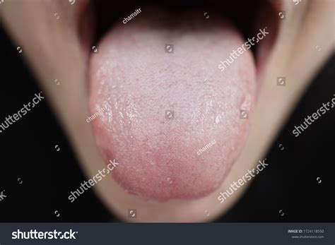 Categoría «human Tongue Close De Fotos E Imágenes Shutterstock