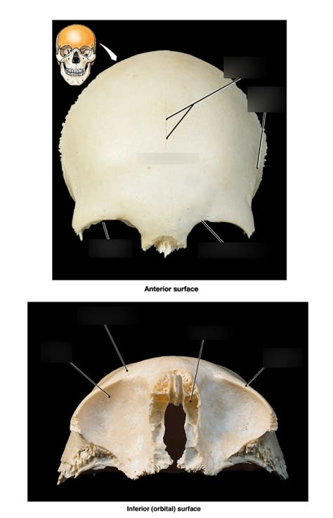 Frontal Bone Diagram Quizlet
