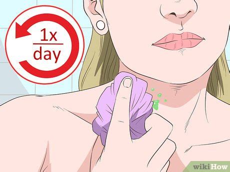 4 Ways To Get Rid Of Neck Acne WikiHow