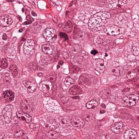 Mitosis Detection Yolo Instance Segmentation Model By Rafi Kk