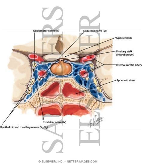 Cavernous Sinus And Its Cranial Nerves