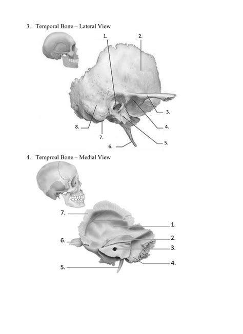 Module 1 Temporal Bone Diagram Quizlet