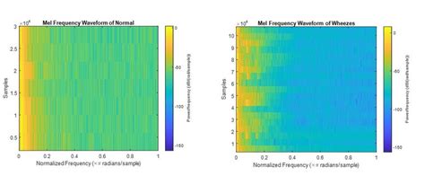 B Mel Frequency Cepstrum Coefficients Of Input Signal Download Scientific Diagram