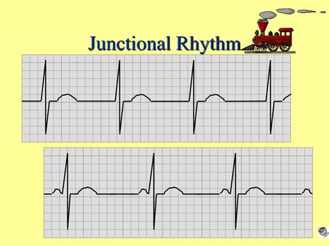 Ppt Name That Rhythm Powerpoint Presentation Free Download Id 3210511