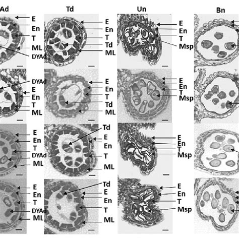Comparative Analysis Of Paraffin Sections Of Fa99 And J411 Anthers At Download Scientific
