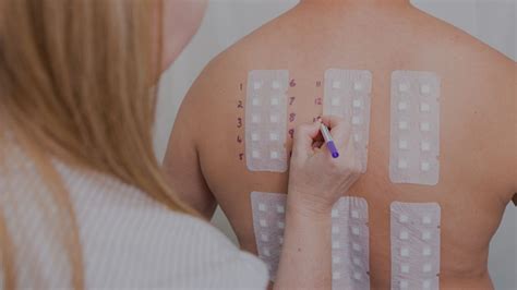 Northern Dermatology Brisbane Allergy Patch Testing Northern Dermatology