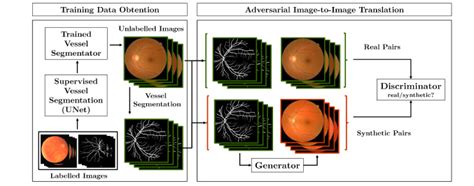 towards adversarial retinal image synthesis deepai