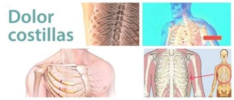 Dolor En Las Costillas Síntomas Causas Niveles De Riesgo Y Tratamiento