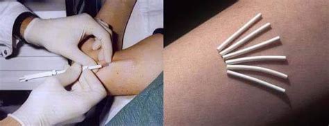 Гэр бүл эмэгтэйчүүдийн эмнэлэг СУУЛГАЦ тавиулсаны дараа юуг анхаарах вэ 1 Тавиулснаас 36