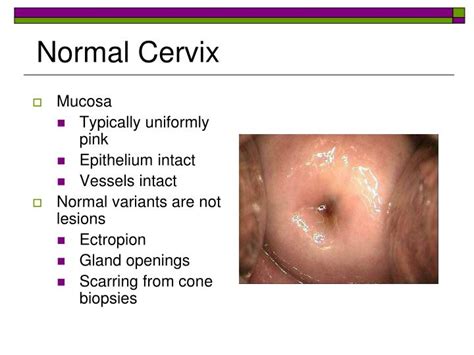Normal Cervical Os