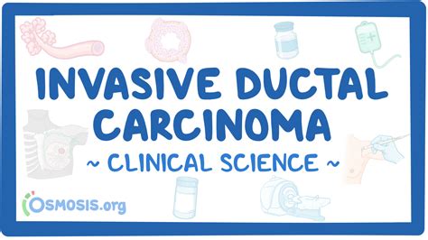 Carcinoma Ductal Invasivo Estrelado