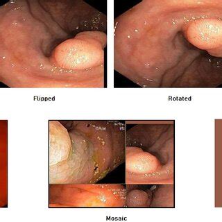 Examples Of The Data Augmentation Methods Used To Train The Model Download Scientific Diagram