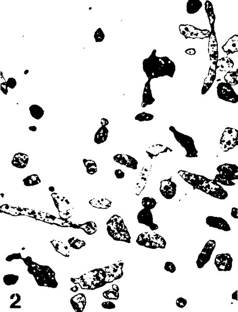 Figure 1 From The Demarcation Membrane System Of The Megakaryocyte A