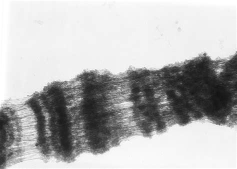 Drosophila Melanogaster Polytene Chromosome Cil24971 Doccheck