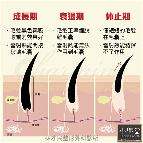 【小學堂】雷射介紹 除毛雷射 林才民整形外科診所ciars