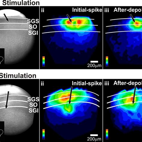 Signal Pattern Depends On The Site Of Stimulation A Mapped Responses