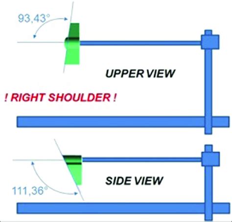 Fixed Retroversion Of The Glenoid Components Of 34° And A Fixed