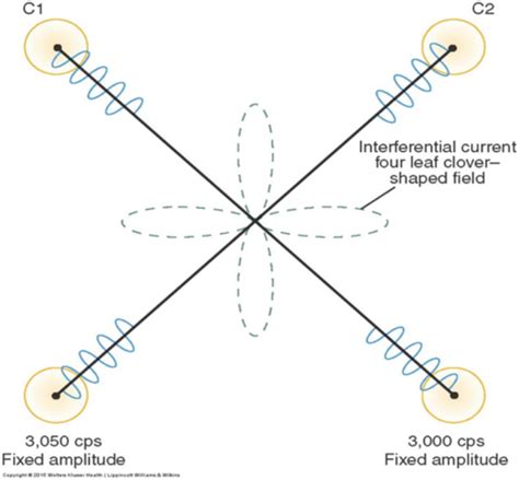 Interferential Currents Ifc Flashcards Quizlet Interferential Currents Ifc Flashcards Quizlet