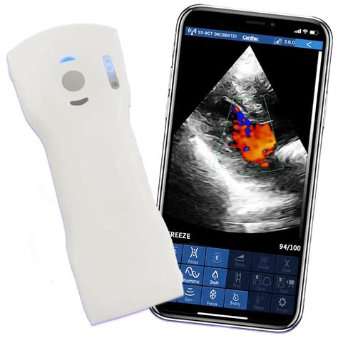 Best Portable Echo Machines 2026 Price And Features