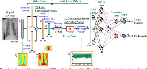 Figure From Chest X Ray Image Analysis With Combining D And D Convolutional Neural Network