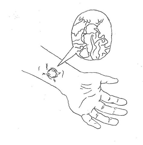 Ringworm Drawing At Getdrawings Free Download