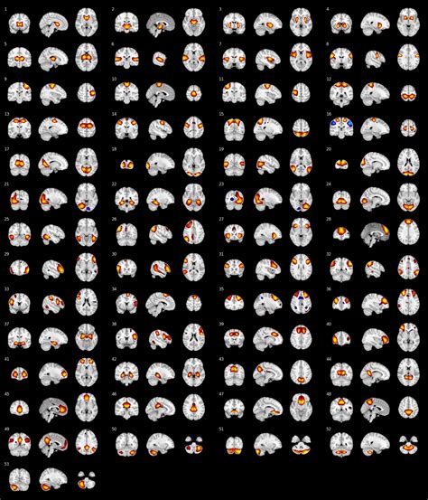 Brainbow · Pypi